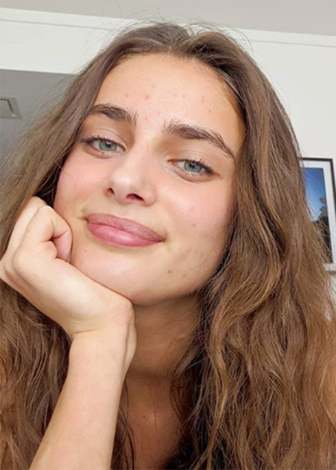 Acné Mapping: Understanding Your Skin – TURQUOISE